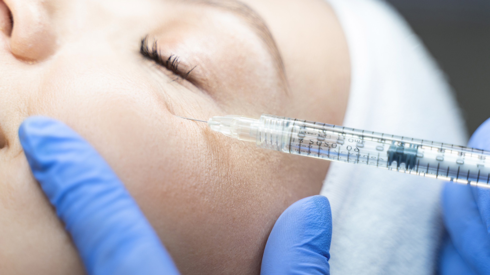 All Your Biggest Questions About Under-Eye Fillers Answered