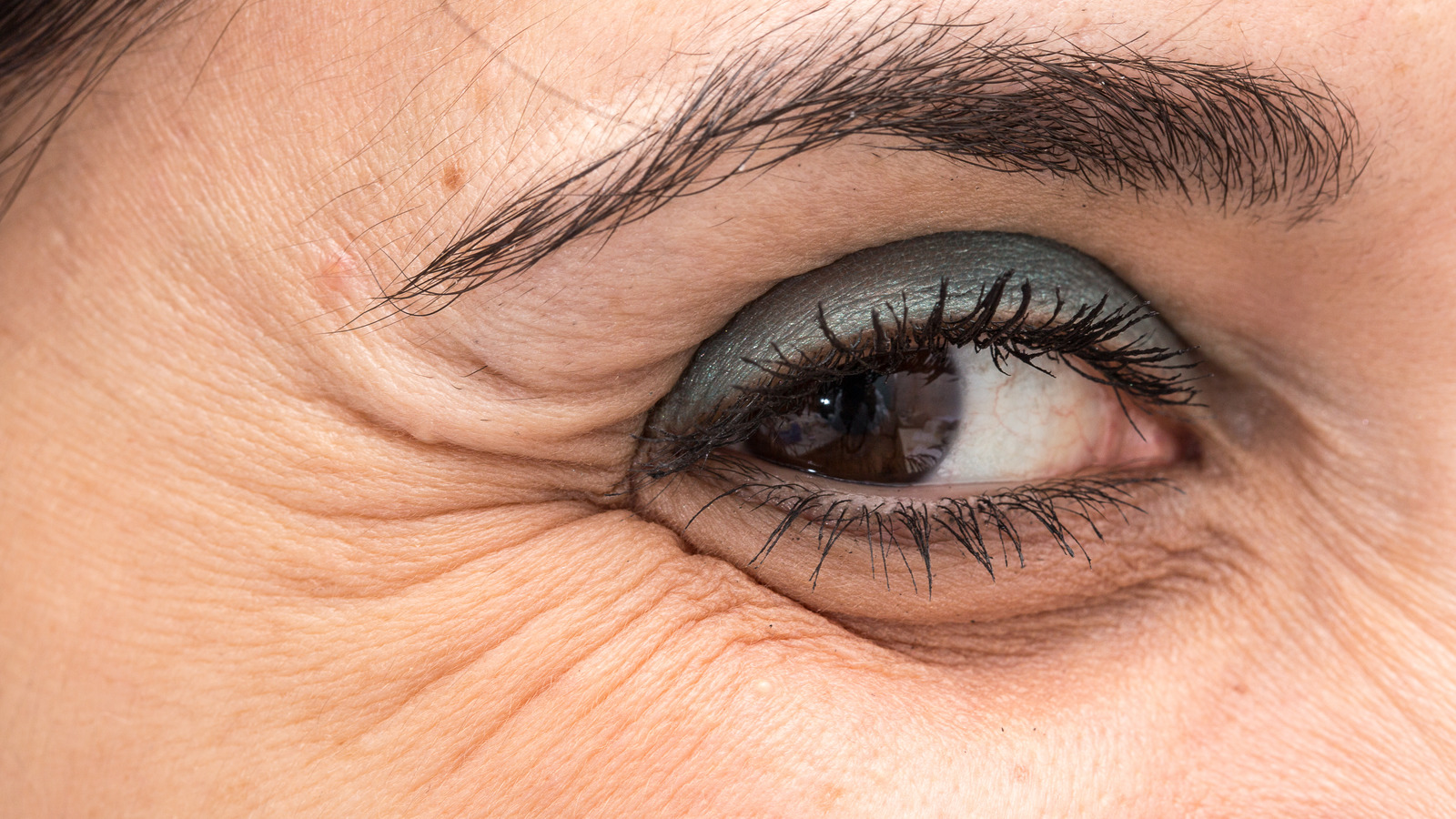 Are Crow's Feet Permanent? Here's What We Know