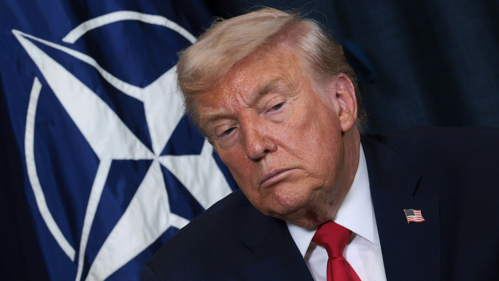 Donald Trump's Bruised Hand Sparks Alarming Comparisons To Queen ...