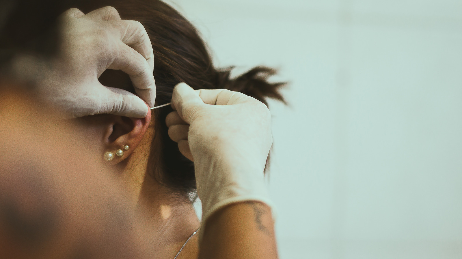 Ear Piercings That Provide Acupuncture Benefits