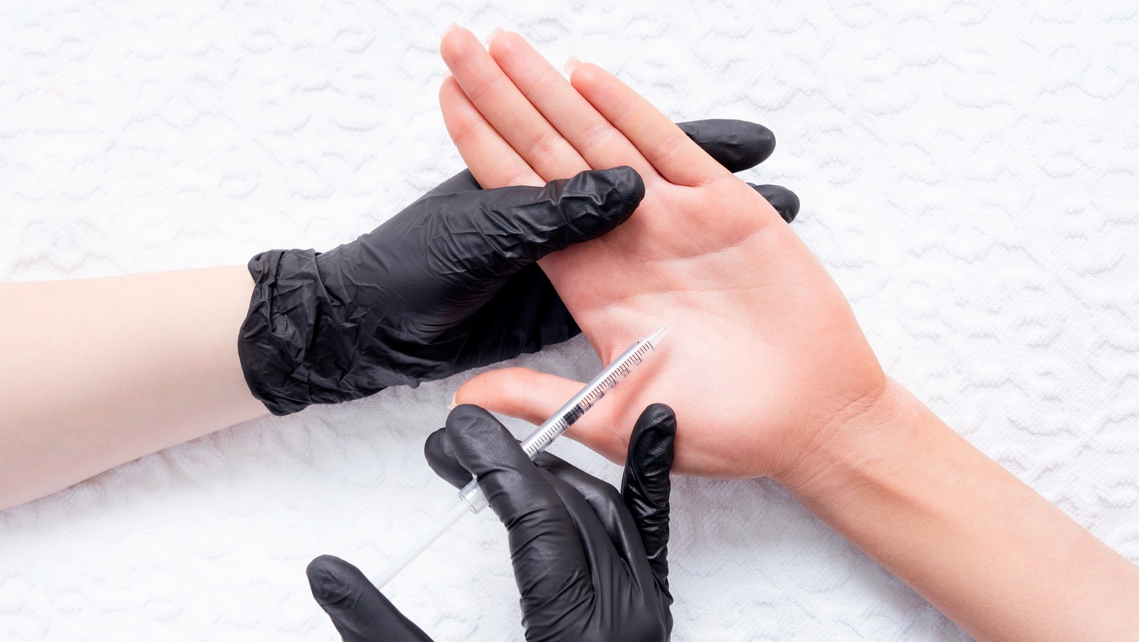 Hand Rejuvenation: The Cosmetic Procedure That Can De-Age Your Hands ...