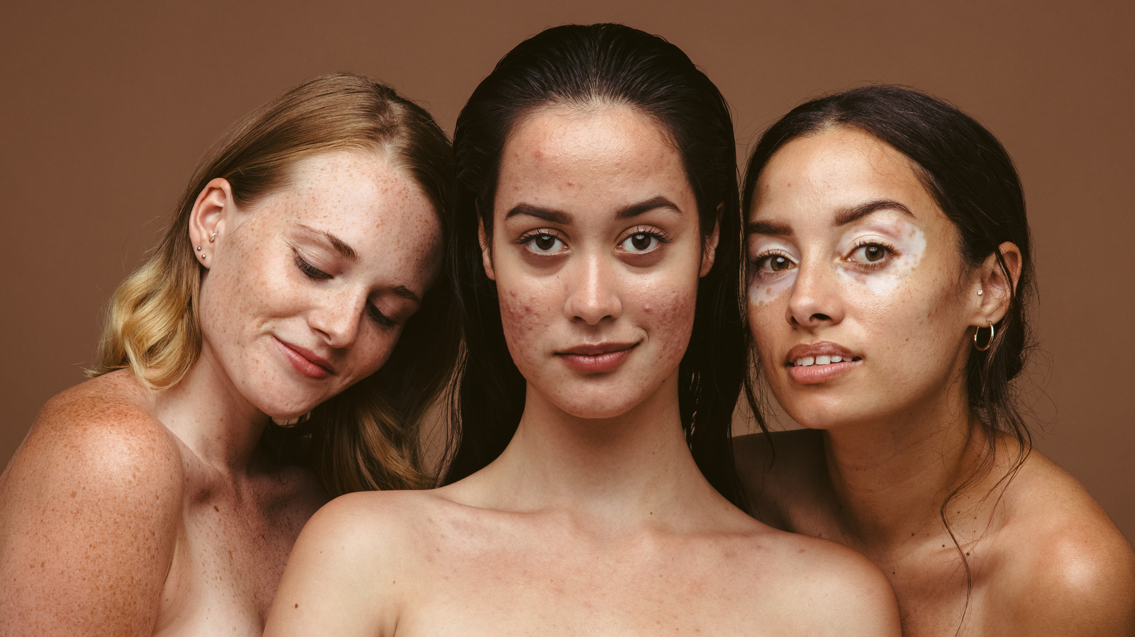 How Skin Positivity, The Movement That Embraces Wrinkles And Acne, Can ...