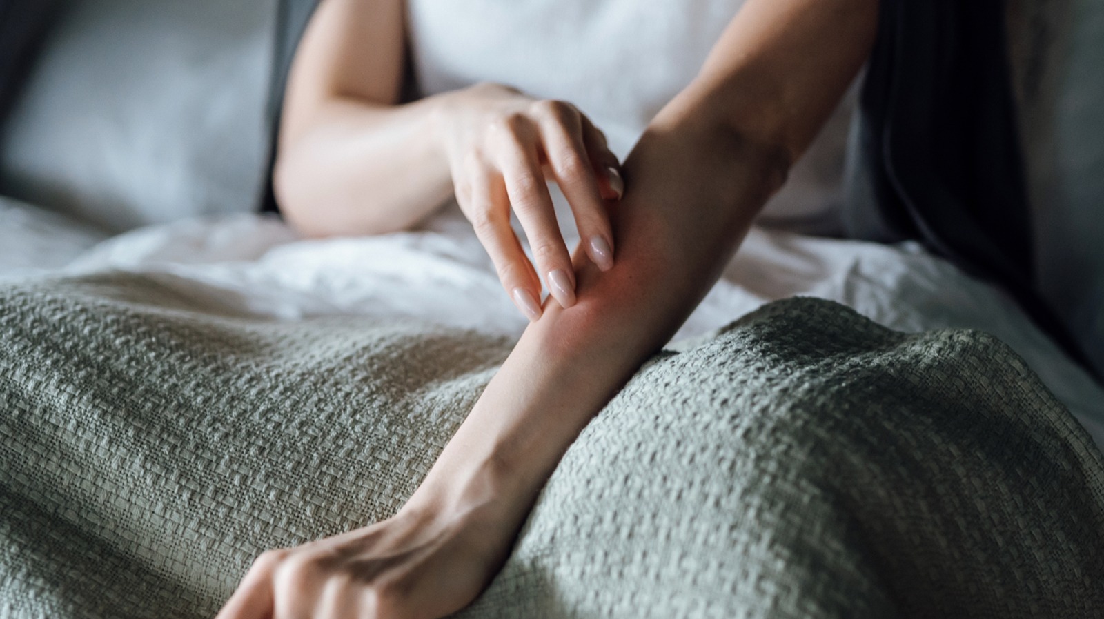 Identifying Different Types Of Eczema And How To Treat Them
