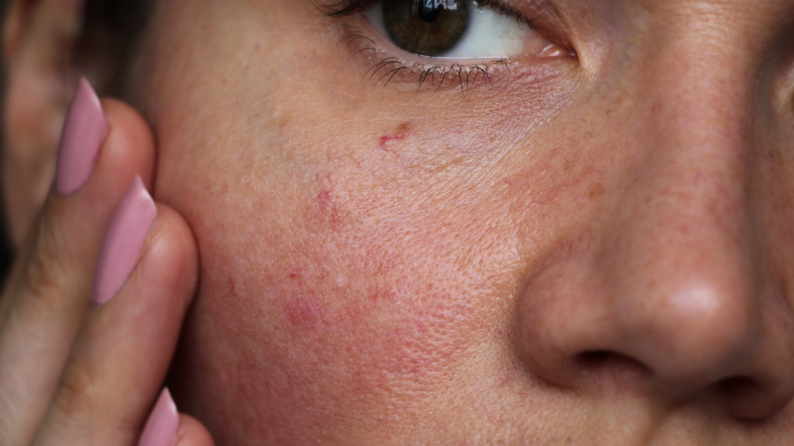 Bumpy Texture On Face