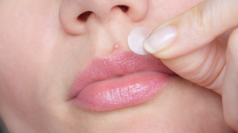 This Is What Happens To Your Skin If You Leave A Hydrocolloid Patch On 