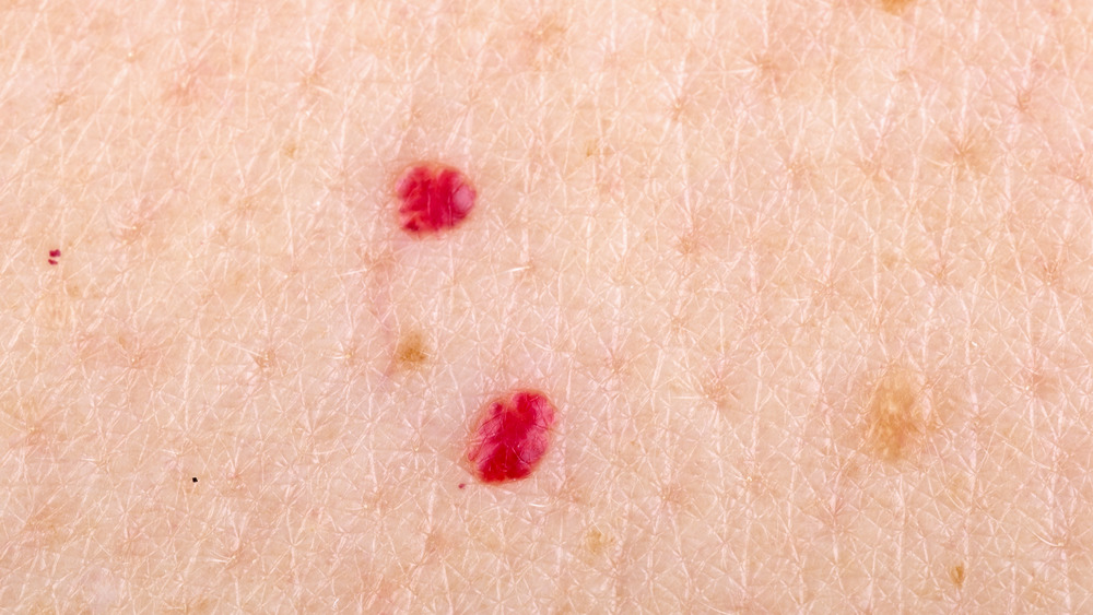 Red Bumps On Skin