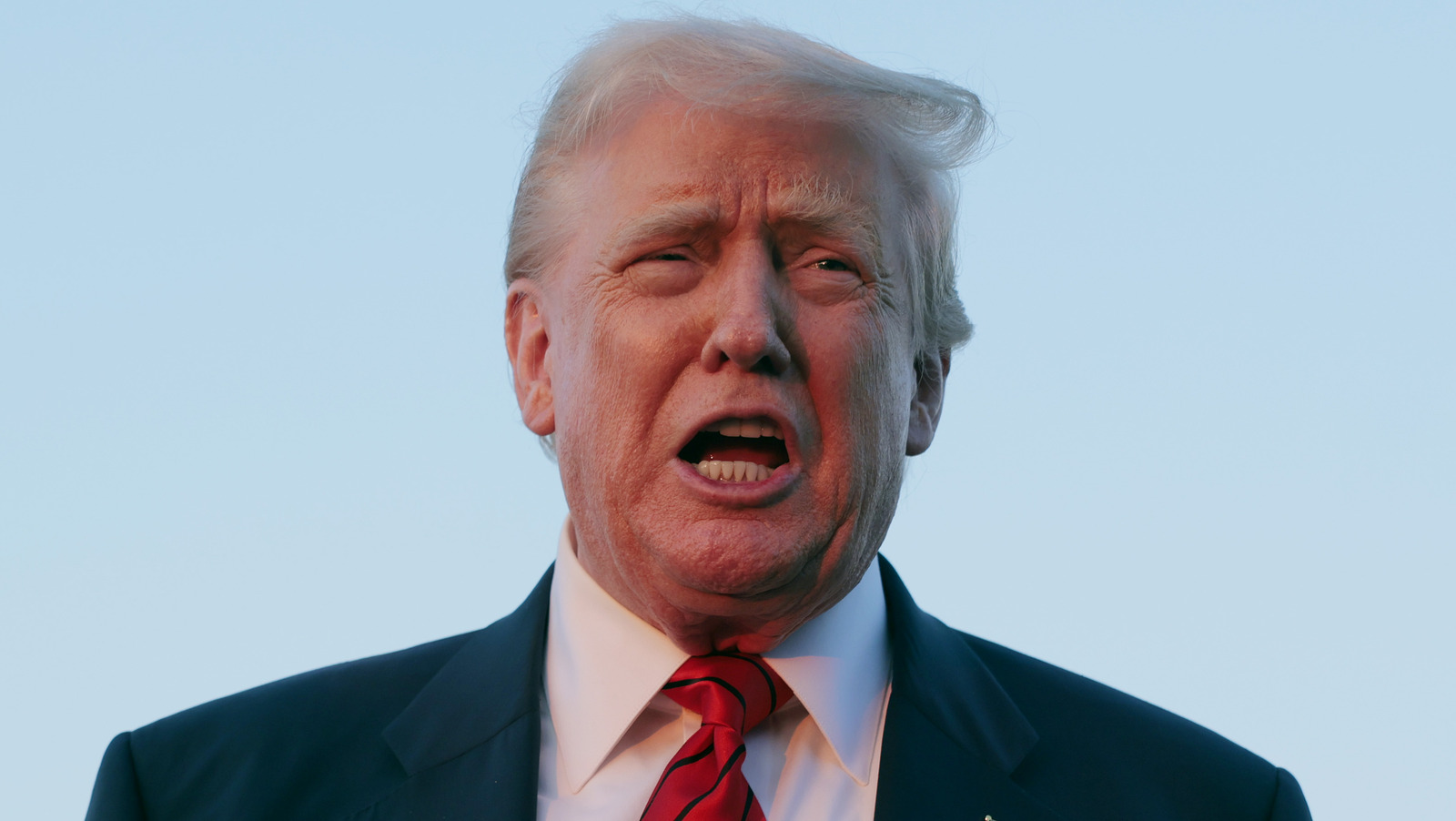 Trump Can't Hide How Deeply His Increasing Bald Spots Hurt His Self-Esteem