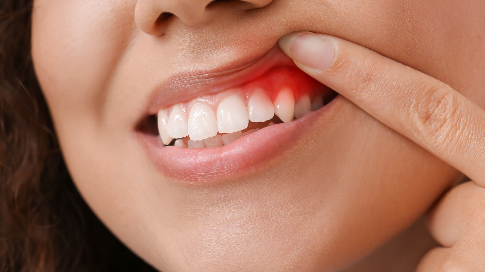 What Does It Mean When Your Gums Are Swollen What Does It Mean When Your Gums Are Swollen