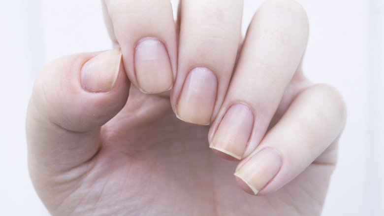 10 Mistakes That Are Destroying Your Nails